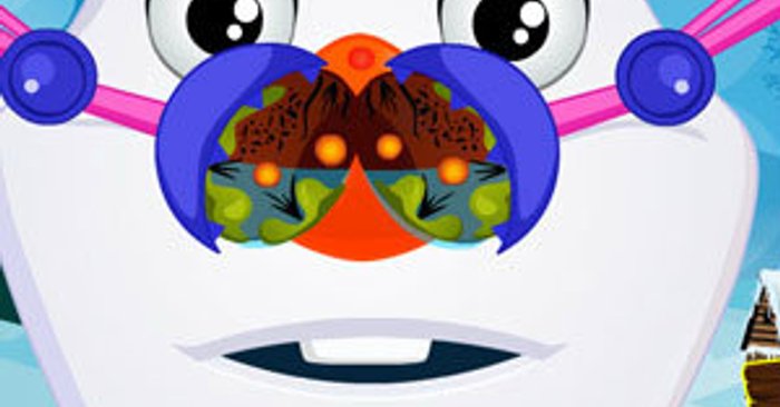 เกมส์ทำความสะอาดจมูก Olaf Nose Doctor
