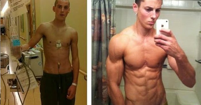 Zach Zeiler จากคนป่วยมะเร็ง สู่นายแบบกล้ามโต